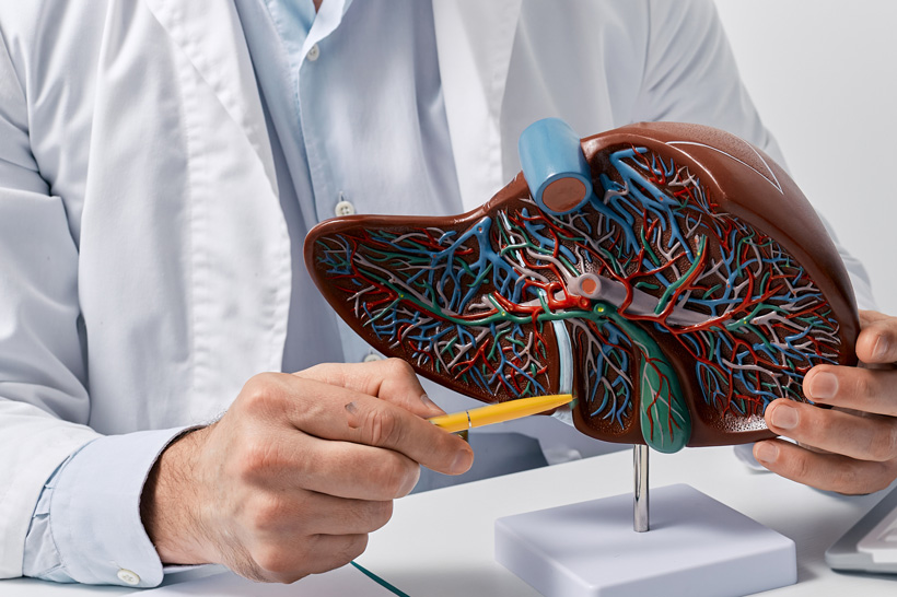 Liver Cancer | Cancer Institute | Memorial Healthcare System